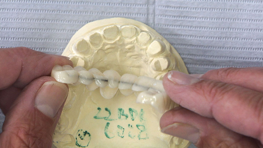 BioTemps Tips and Tricks for Successful Seating – Case of the Week ...