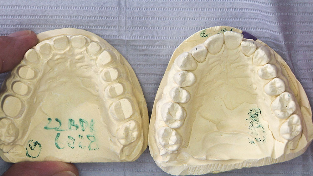 BioTemps Tips and Tricks for Successful Seating – Case of the Week ...