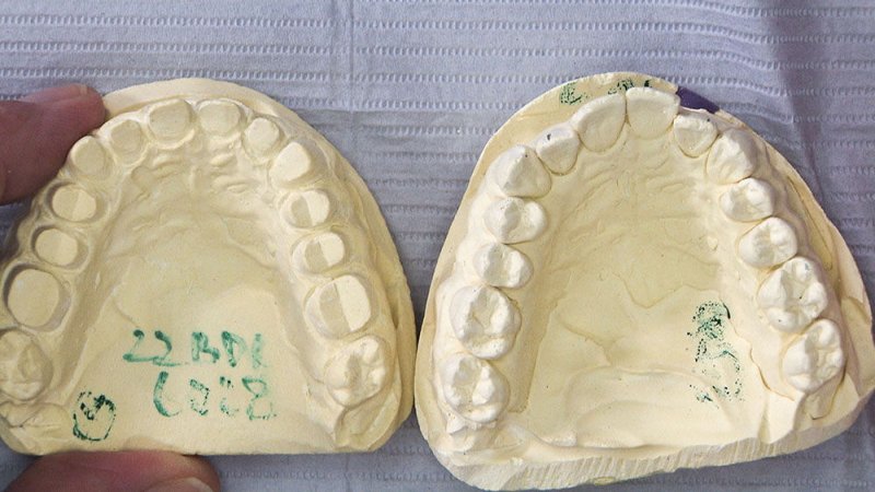 BioTemps Tips and Tricks for Successful Seating – Case of the Week ...