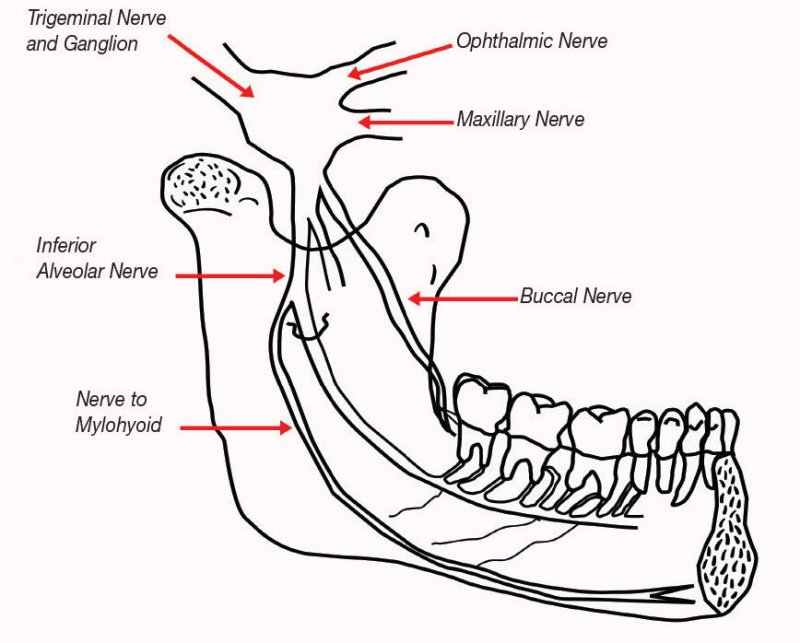 Four Common Mandibular Nerve Anomalies That Lead to Local Anesthesia ...