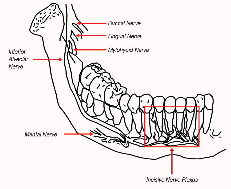 Four Common Mandibular Nerve Anomalies That Lead to Local Anesthesia ...