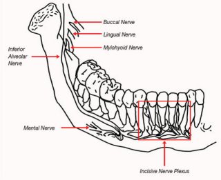 Four Common Mandibular Nerve Anomalies That Lead to Local Anesthesia ...