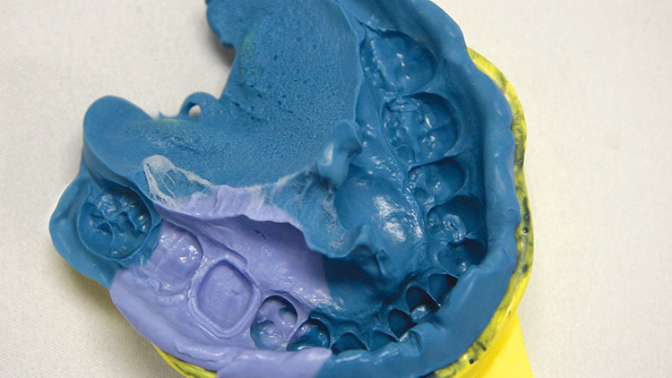 The Hydraulic & Hydrophobic Impression Technique: Facts Based on the ...