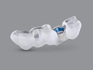 Dental Implant Surgical Guide: How To Choose The Right One