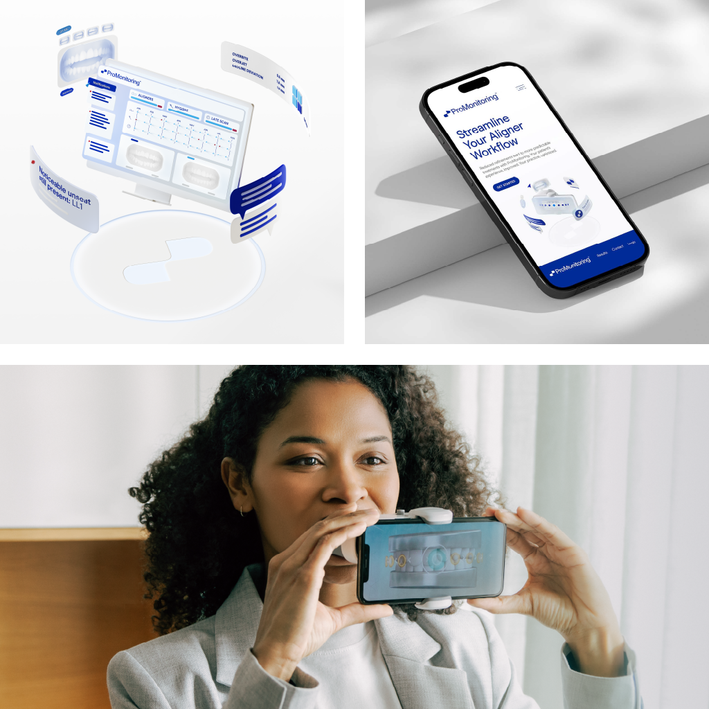 Glidewell Clear Aligners: Powered by ProMonitoring