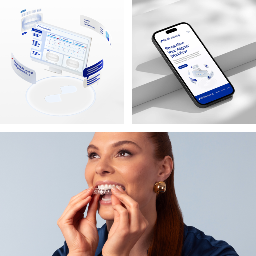 Glidewell Clear Aligners: Powered by ProMonitoring