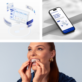 Glidewell Clear Aligners: Powered by ProMonitoring