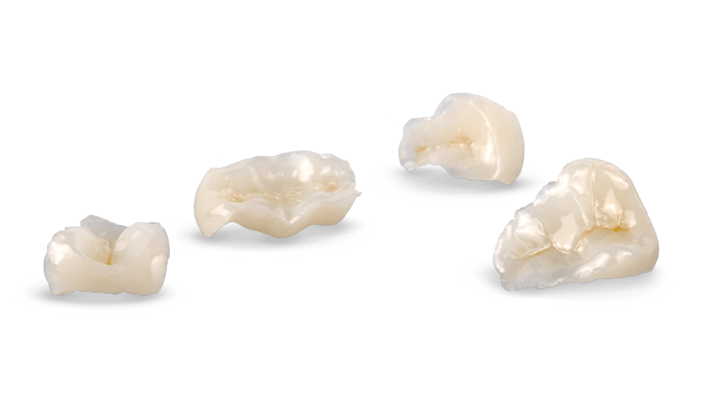 Composite Restorations - Composite Restorations