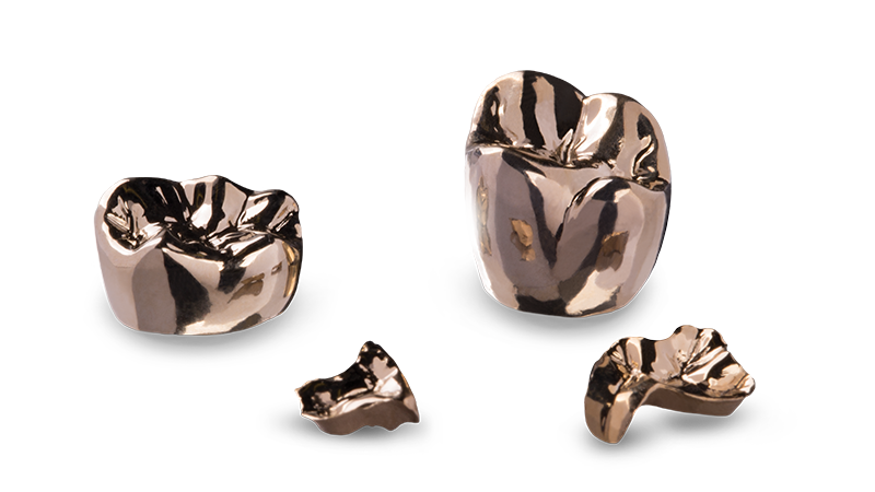 Full-Cast Gold Crowns - Full-Cast Restorations - Glidewell