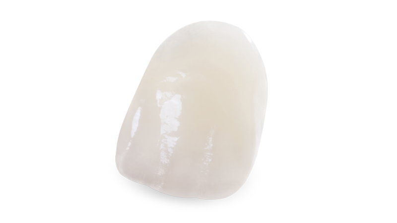 IPS e.max is an alternative to zirconia-based restorations