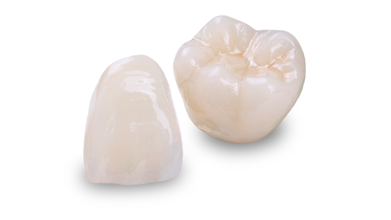 Obsidian All-Ceramic Crowns - Glidewell - Crown Lab