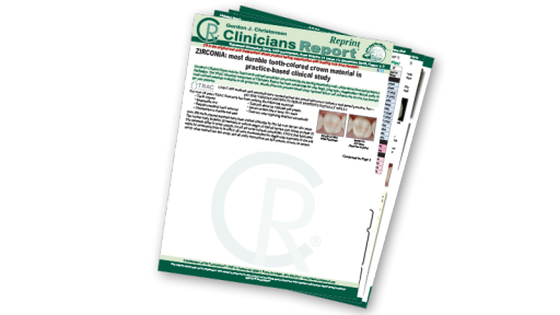 CAMouflage NOW for Inlays, Onlays, Veneers, Dental Crowns