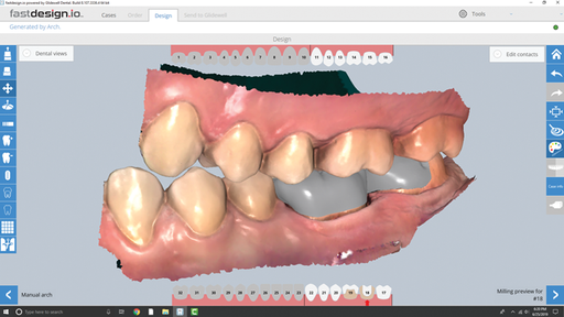 fastdesign.io - Dental Scan & Software - Same-Visit Dental