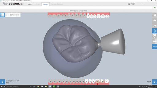 fastdesign.io - Dental Scan & Software - Same-Visit Dental