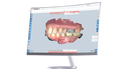 fastdesign.io - Dental Scan & Software - Same-Visit Dental