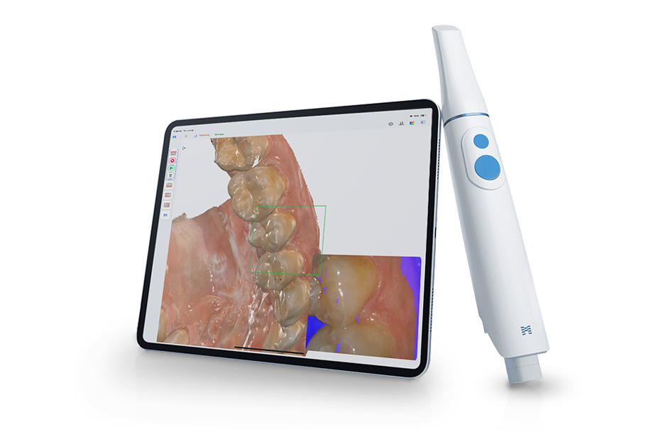 fastscan.io™ Scanning Solution Medit i900 Mobility | Connected to ...