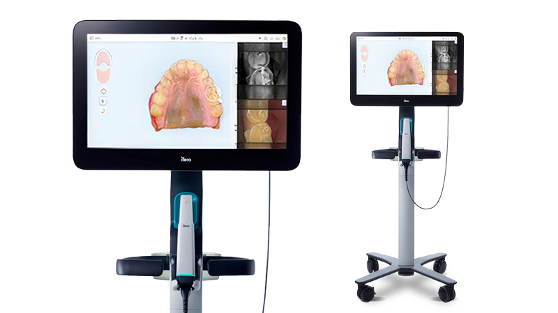 iTero Lumina™ Intraoral Scanner