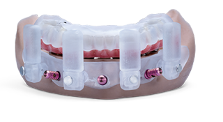 Stackable Surgical Guides - Glidewell Labs