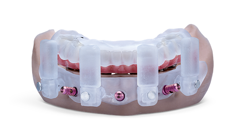 Stackable Surgical Guides - Glidewell Labs