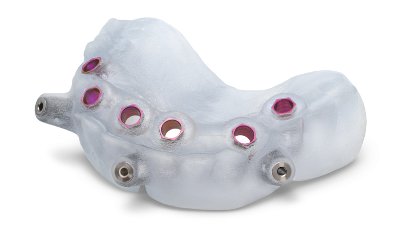Surgical Guide for Dental Implant Placement - Glidewell Labs