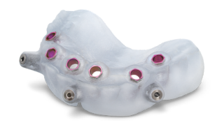 Surgical Guide for Dental Implant Placement - Glidewell Labs