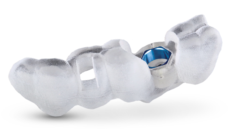 Surgical Guide For Dental Implant Placement Glidewell Labs