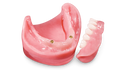 Locator Overdentures To Improve Retention and Speech