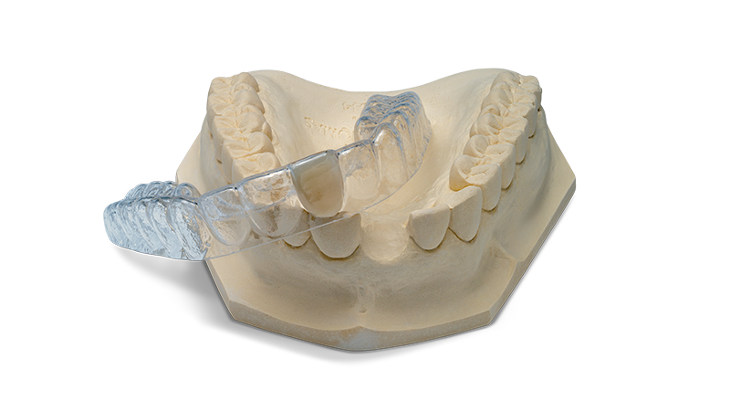 Essix Retainer - Glidewell