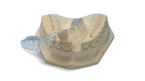 Essix Retainer - Glidewell