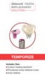 Glidewell™ Tooth Replacement Solution