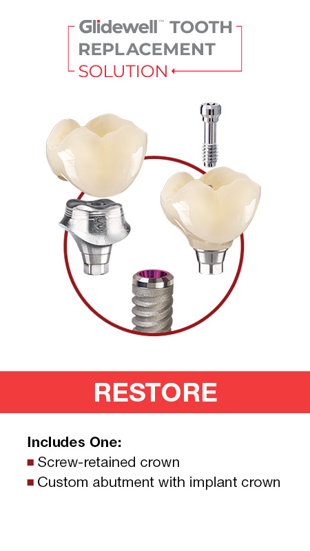 Glidewell™ Tooth Replacement Solution