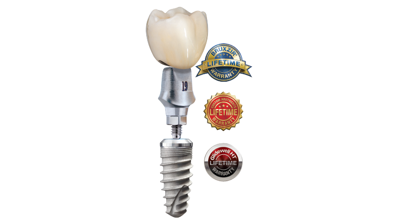 Glidewell™ Tooth Replacement Solution