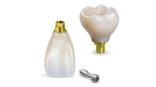 Screw-Retained Implant Crown - Glidewell Dental Lab