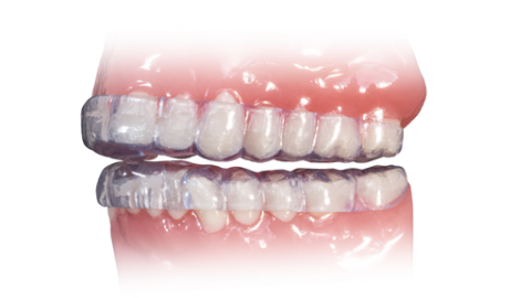 NTI OmniSplint from Glidewell