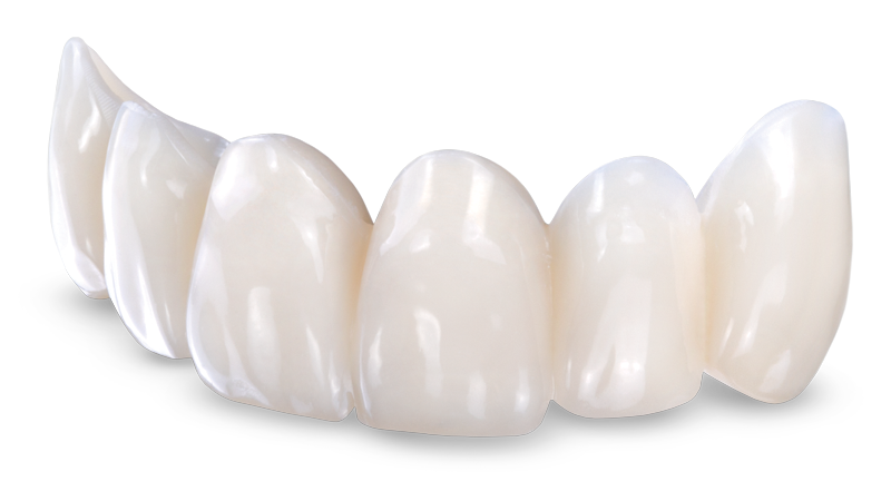 BioTemps® Provisionals - Glidewell Dental Lab