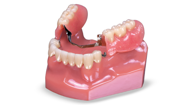 Glidewell Labs - Exceptional Combination Crowns and Partials