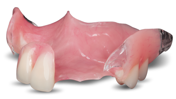 Reflex™ Plus: The most comfortable flexible partial denture!