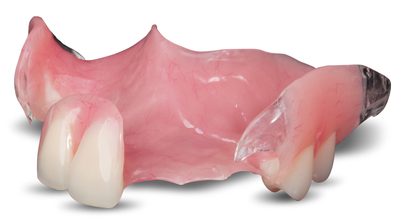 Reflex™ Plus: The most comfortable flexible partial denture!