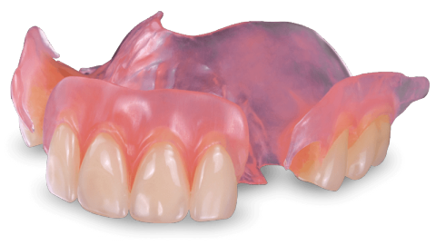 Flexible Partial Dentures - Glidewell Dental Labs