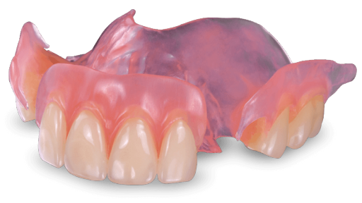 Flexible Partial Dentures - Glidewell Dental Labs