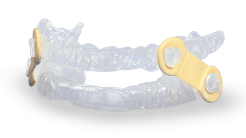 Mandibular Advancement Device - EMA® Oral Appliance