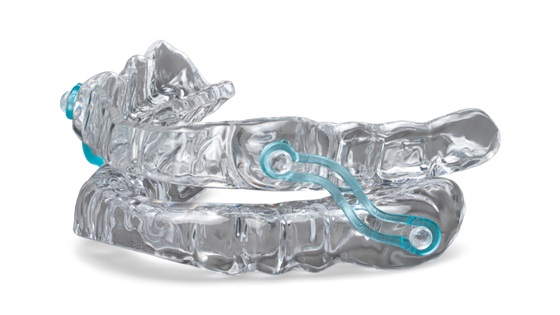 Silent Nite – Oral Appliance for Sleep Apnea