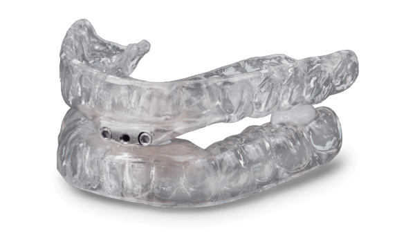 How to Stop Snoring? TAP® 3 TL - Stop Snoring Devices