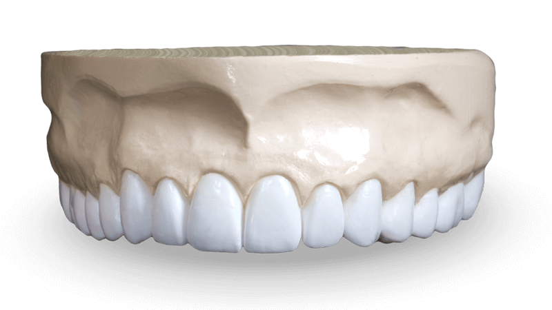 Offer your patients an accurate preview of their final case